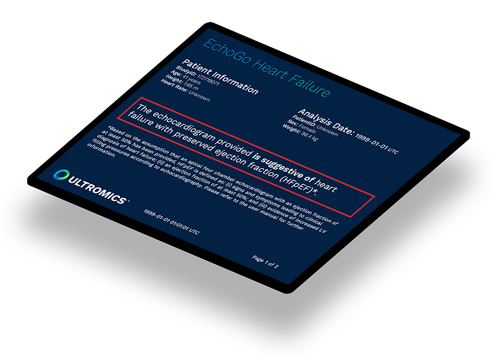 Next-generation Echocardiography is here - Ultromics Next-generation Echocardiography is here - Ultromics